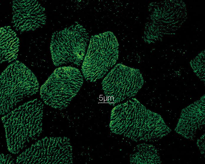 Super-Resolution Microscopy Comes into Focus