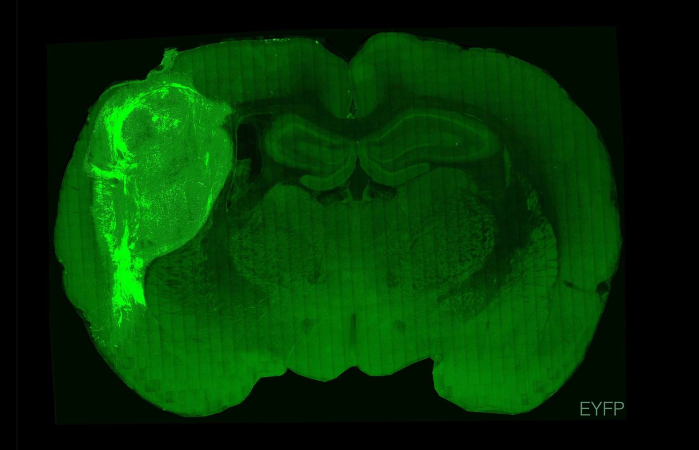 Neural Organoids Making Connections, Getting Real