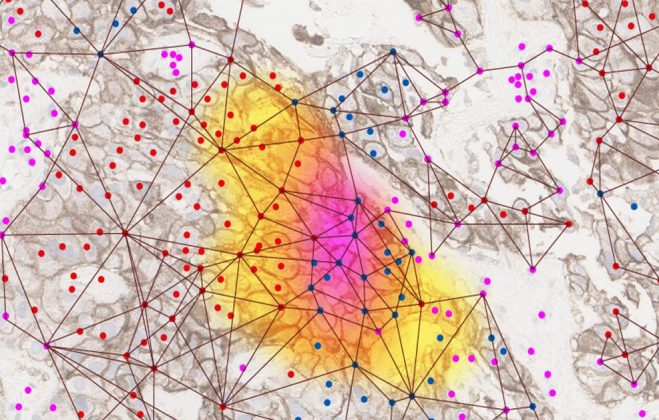Spatial Multiomics Powers Pathology Prediction