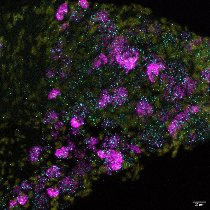Chronic Pain Treatments Could Target Ion Channel Implicated in Touch ...