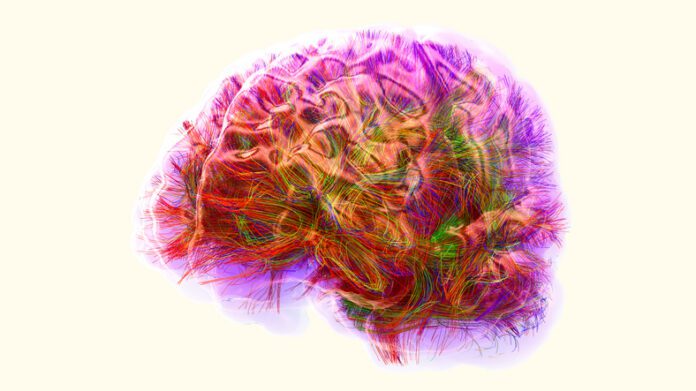 Disease Detection Gets Boost from Keck’s New Brain Reference Map